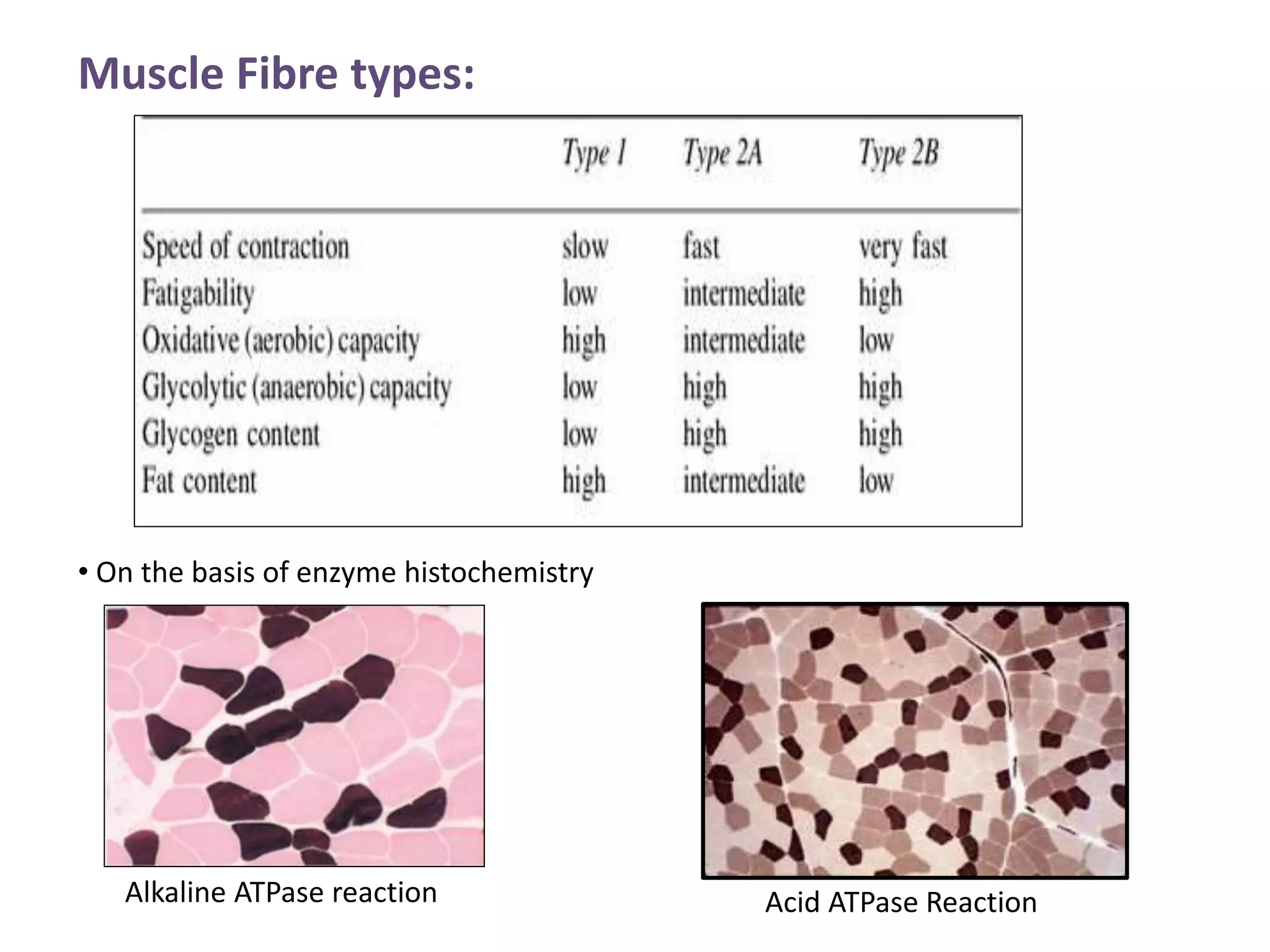 Inflammatory Myopathies | PPTX