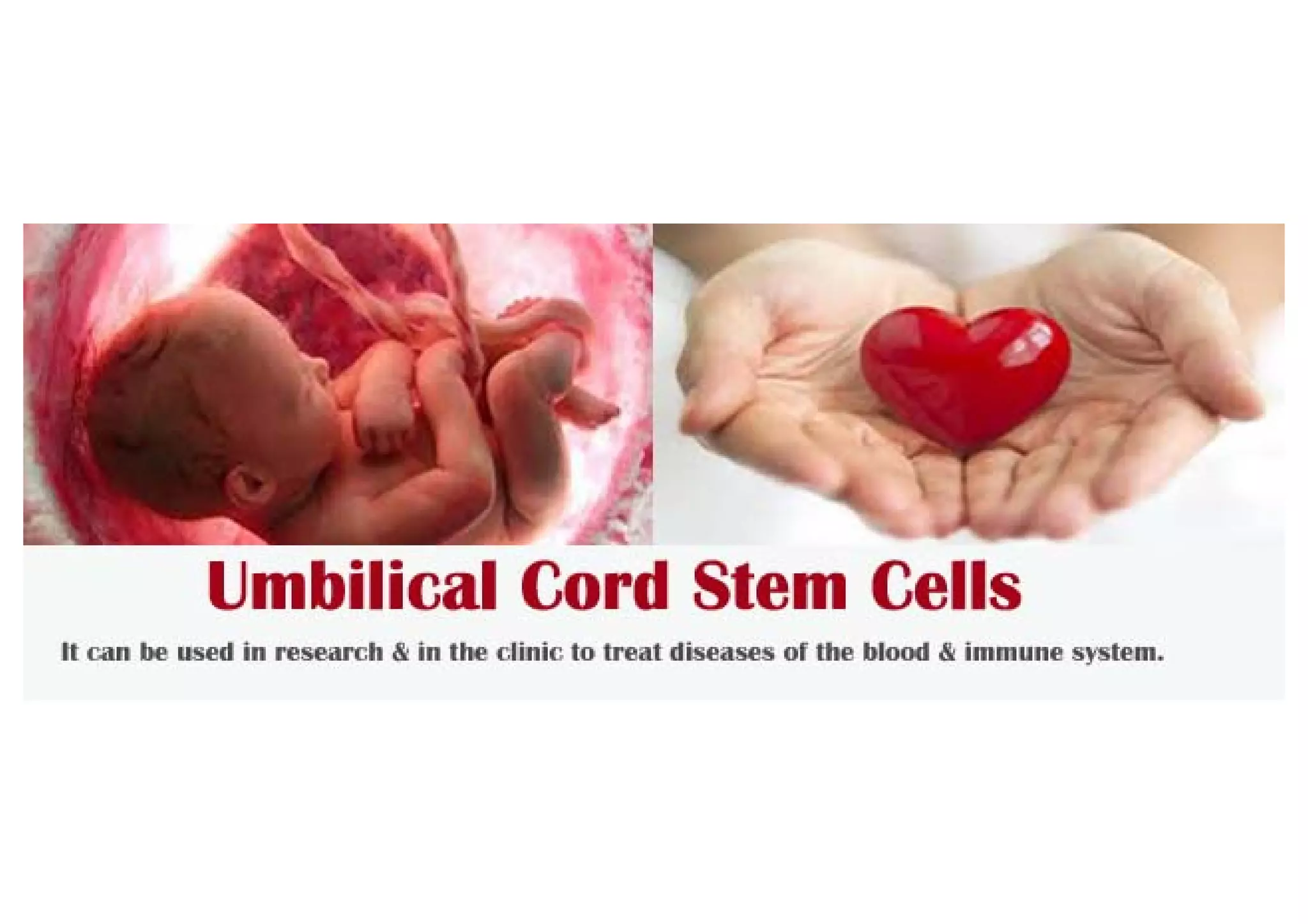 Umbilical Cord Stem Cells | PDF