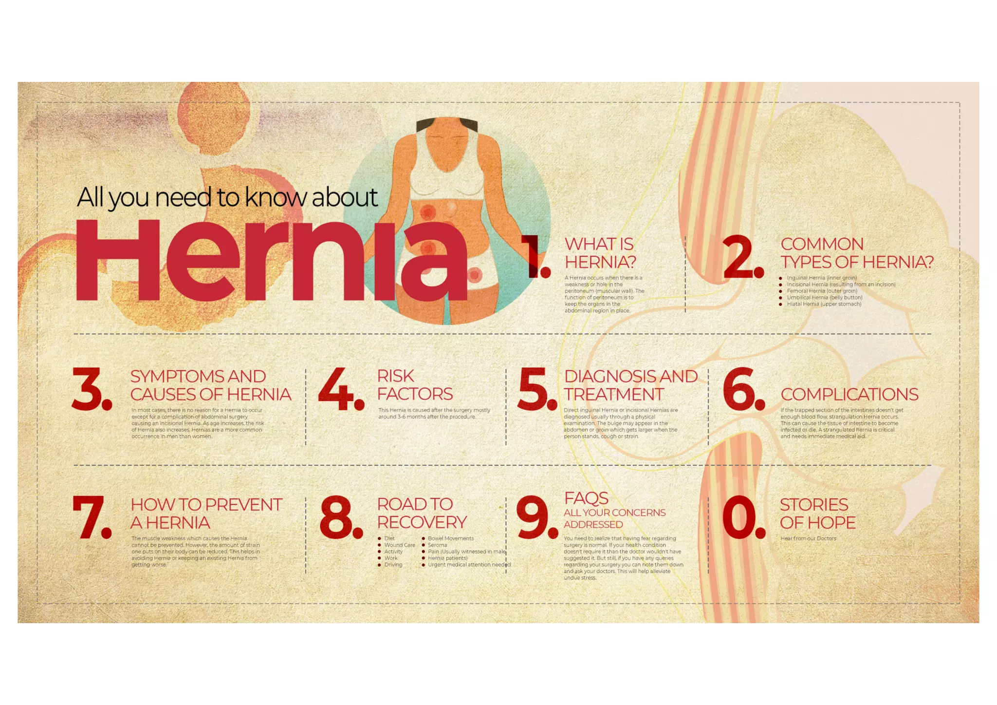All about Hernia | PPT