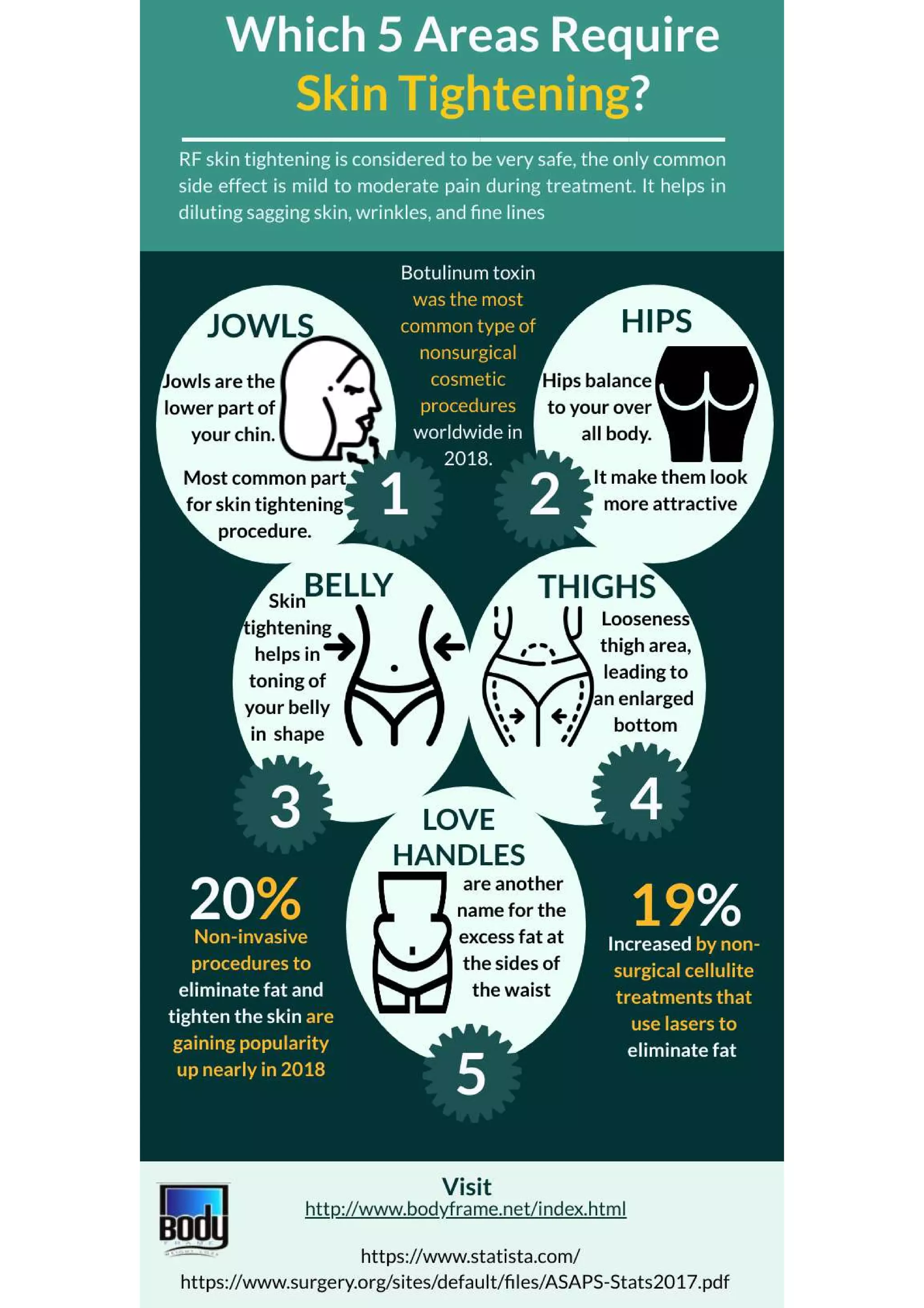 Which 5 Areas Require Skin Tightening? | PDF