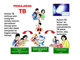 Informasi Dasar TB.pptx . PENGERTIAN TB DAN GEJALA | PPTX