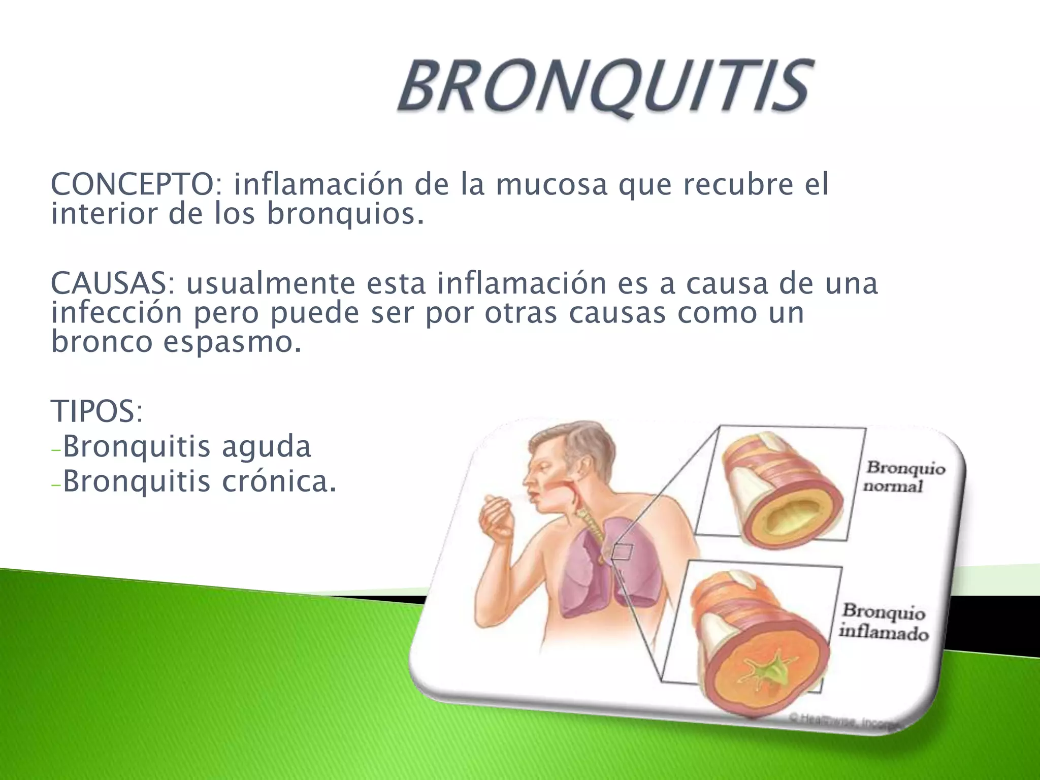 bronquitis y cuidados de enfermeria | PPT
