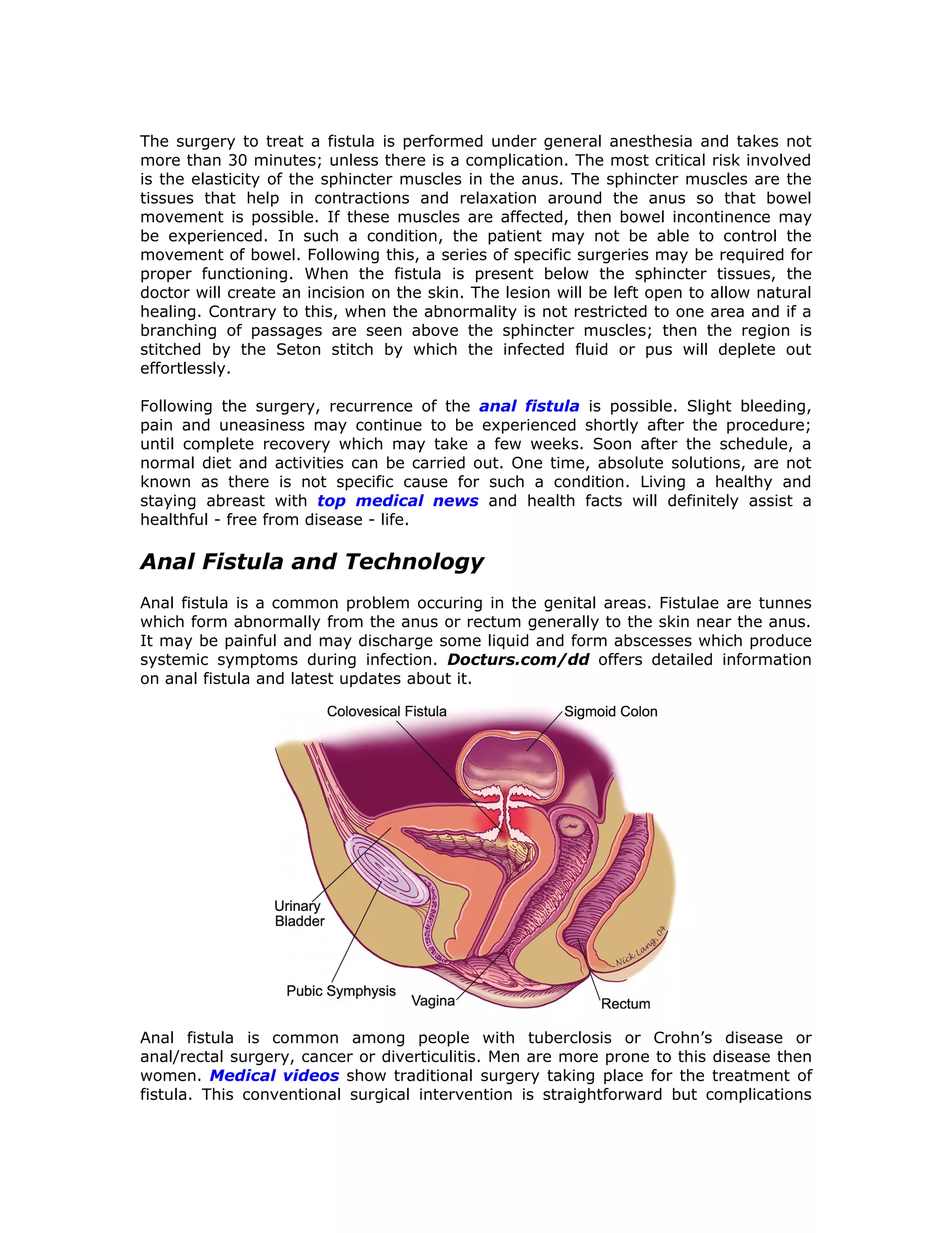 Information about anal fistula | DOC