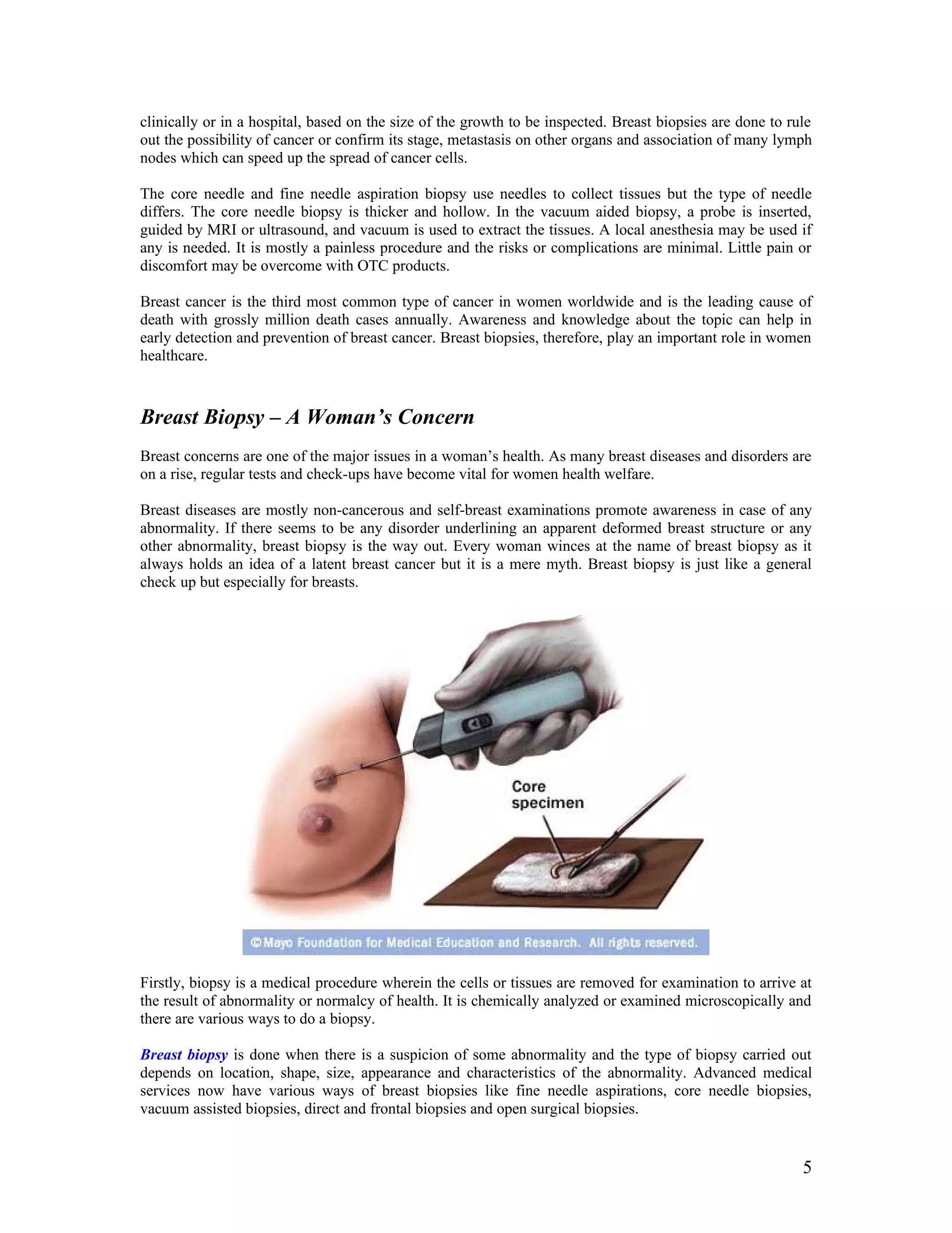 Information about Breast Biopsy | PDF