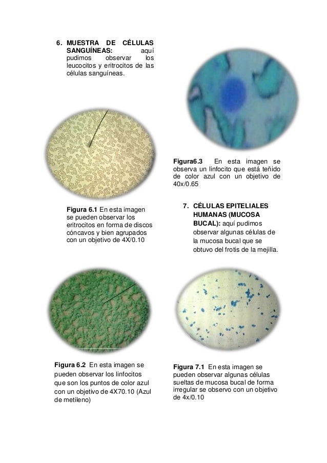 Observación Al Microscopio De Células Del Epitelio Bucal - Compartir ...