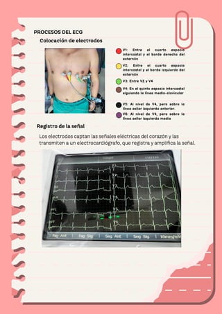 INFORME DE ECG Y ANATOMIA DEL CORAZON.pdf
