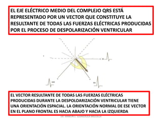 INFORME ELECTROCARDIOGRÁFICO.pptx