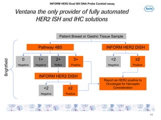 Inform Her2 DUAL ISH | PDF