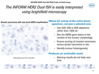 Inform Her2 DUAL ISH | PDF