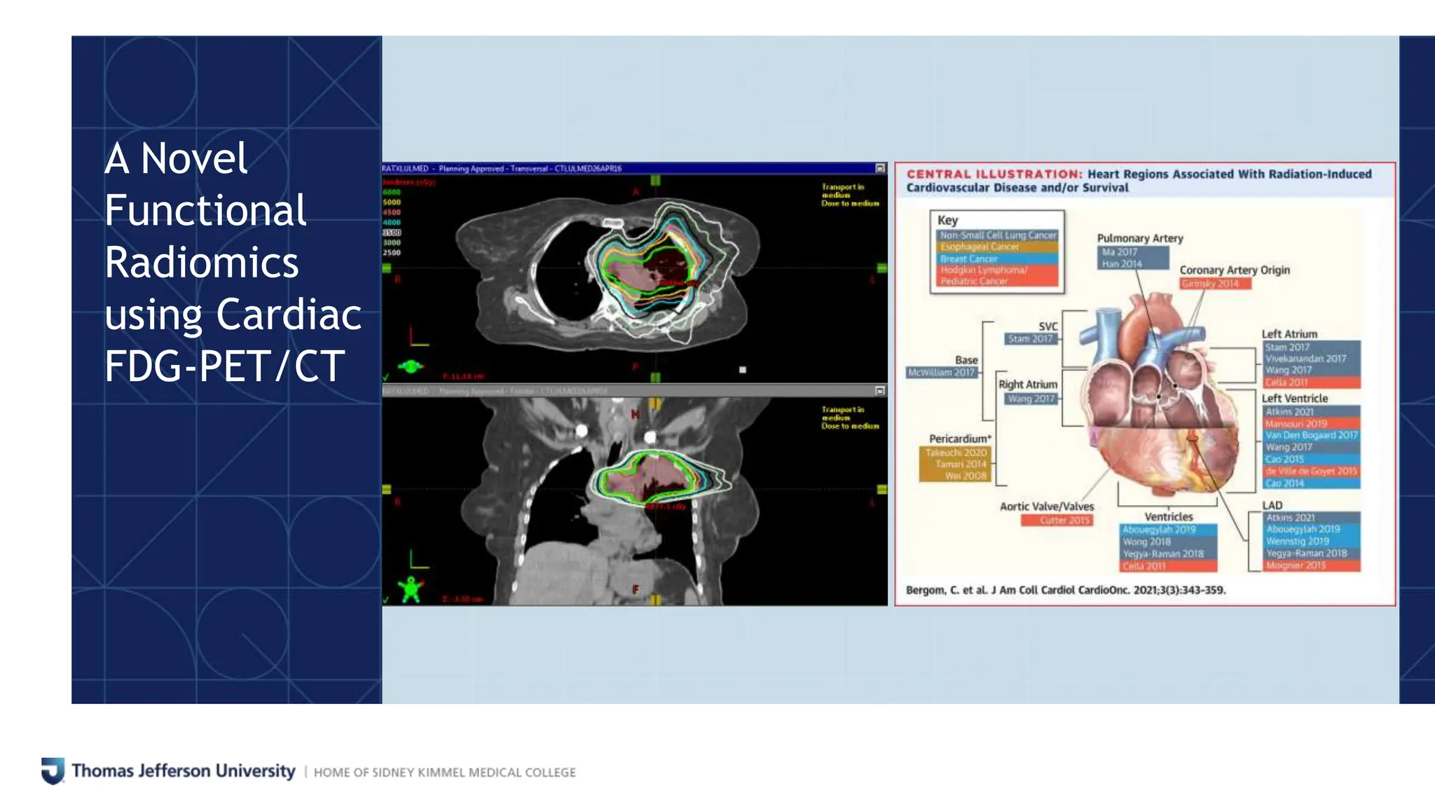 Artificial Intelligence To Reduce Radiation-induced Cardiotoxicity In ...