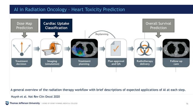 Artificial Intelligence To Reduce Radiation-induced Cardiotoxicity In Lung Cancer Radiotherapy ...