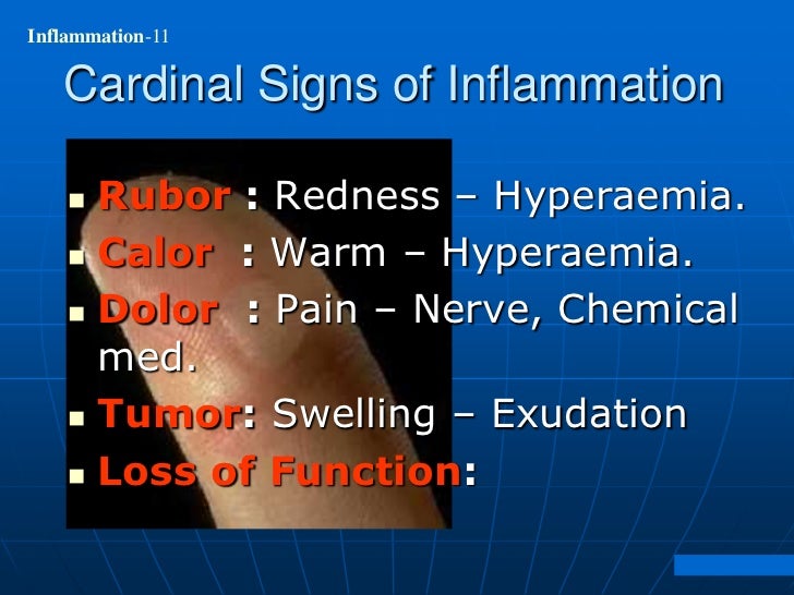 Positive Ions Inflammation