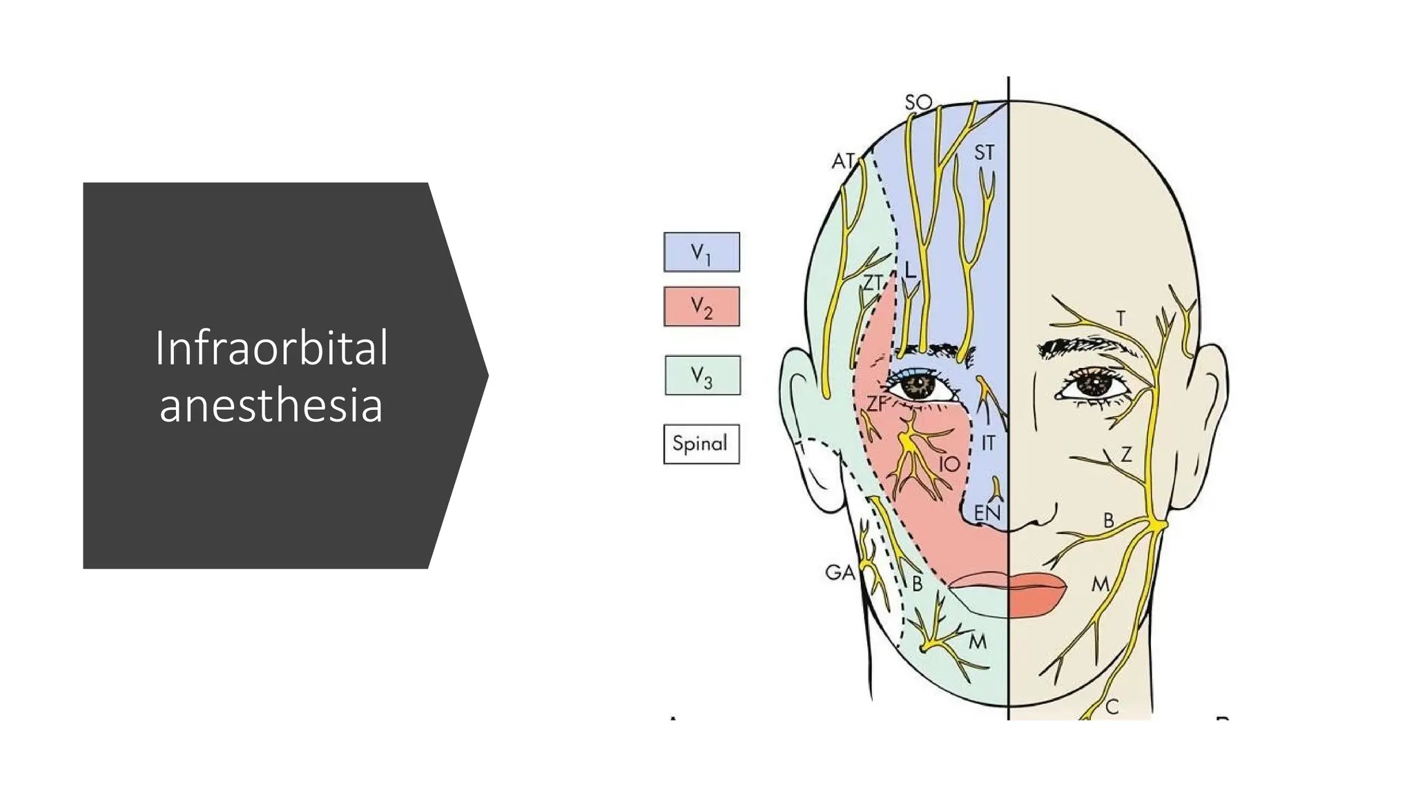 infra Ring splint. It is a set of soldered metal rings that, w.pptx