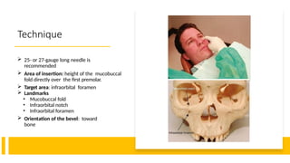 infra Ring splint. It is a set of soldered metal rings that, w.pptx