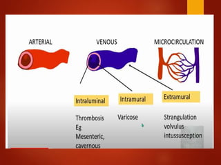 Infraction - Dr. Abhinav Golla MD. Pathology | PPT