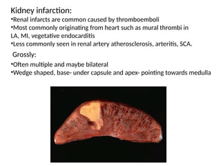 infraction ppt pathology for practical.pptx | Heart and Cardiovascular ...