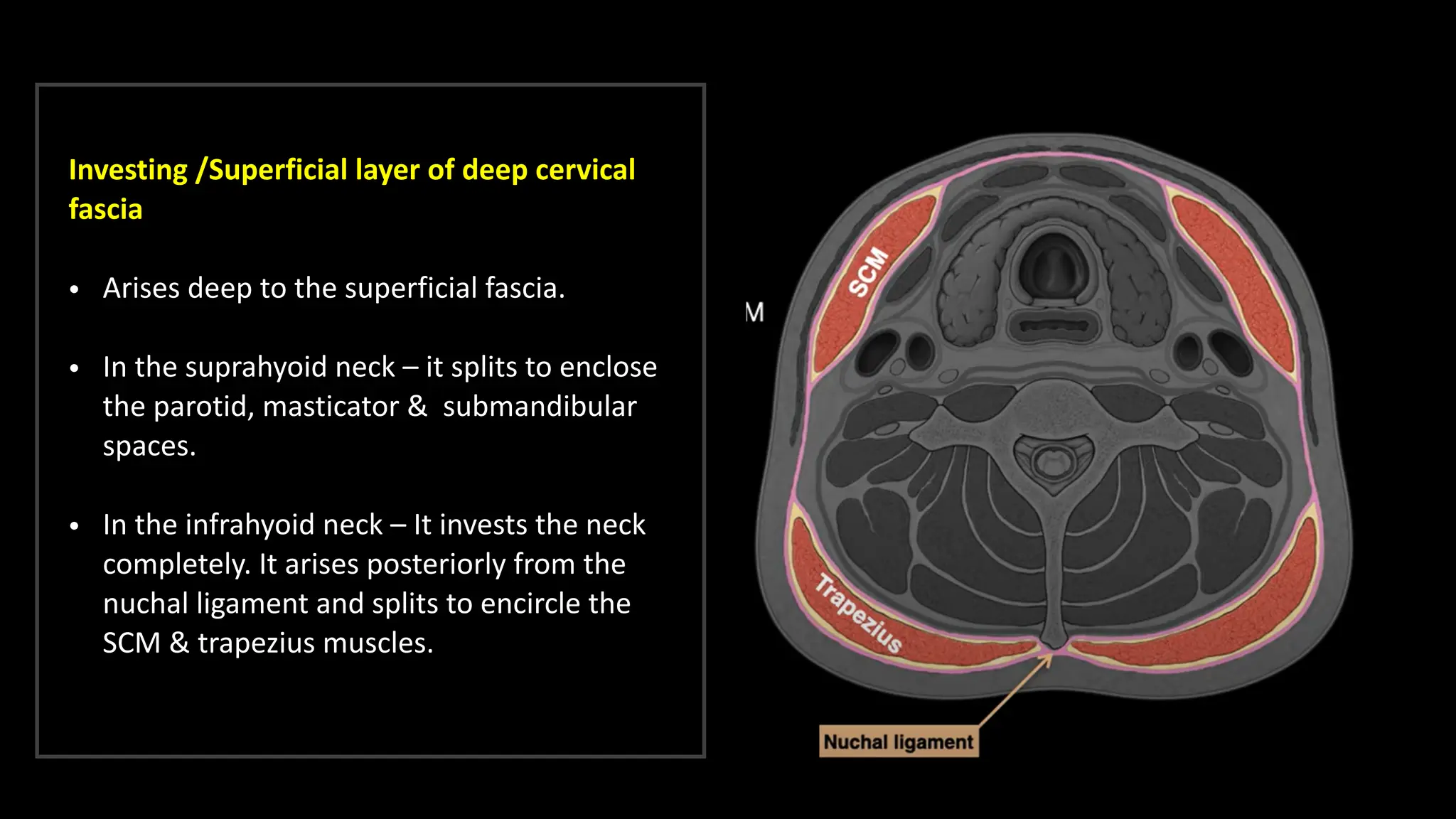 Imaging of the Infrahyoid neck spaces.pdf