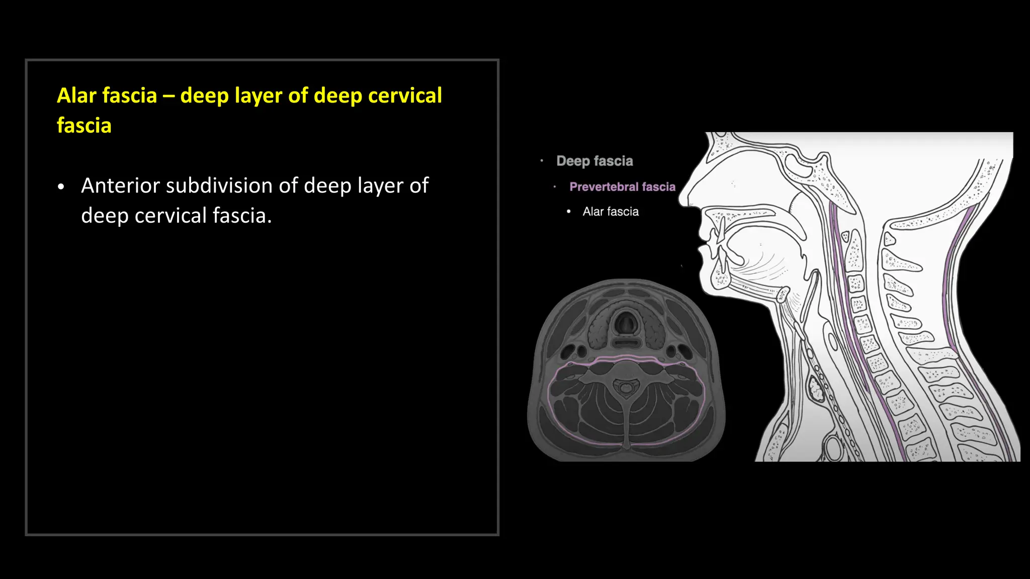 Imaging of the Infrahyoid neck spaces.pdf