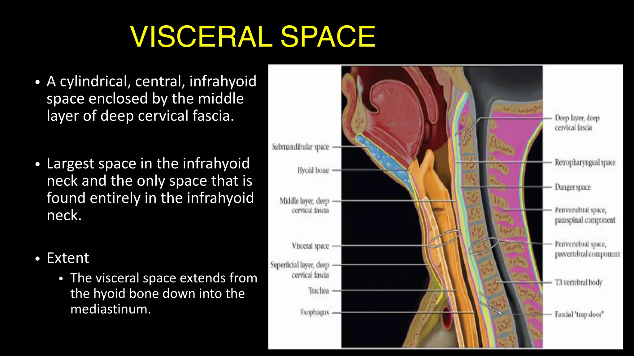 Imaging of the Infrahyoid neck spaces.pdf