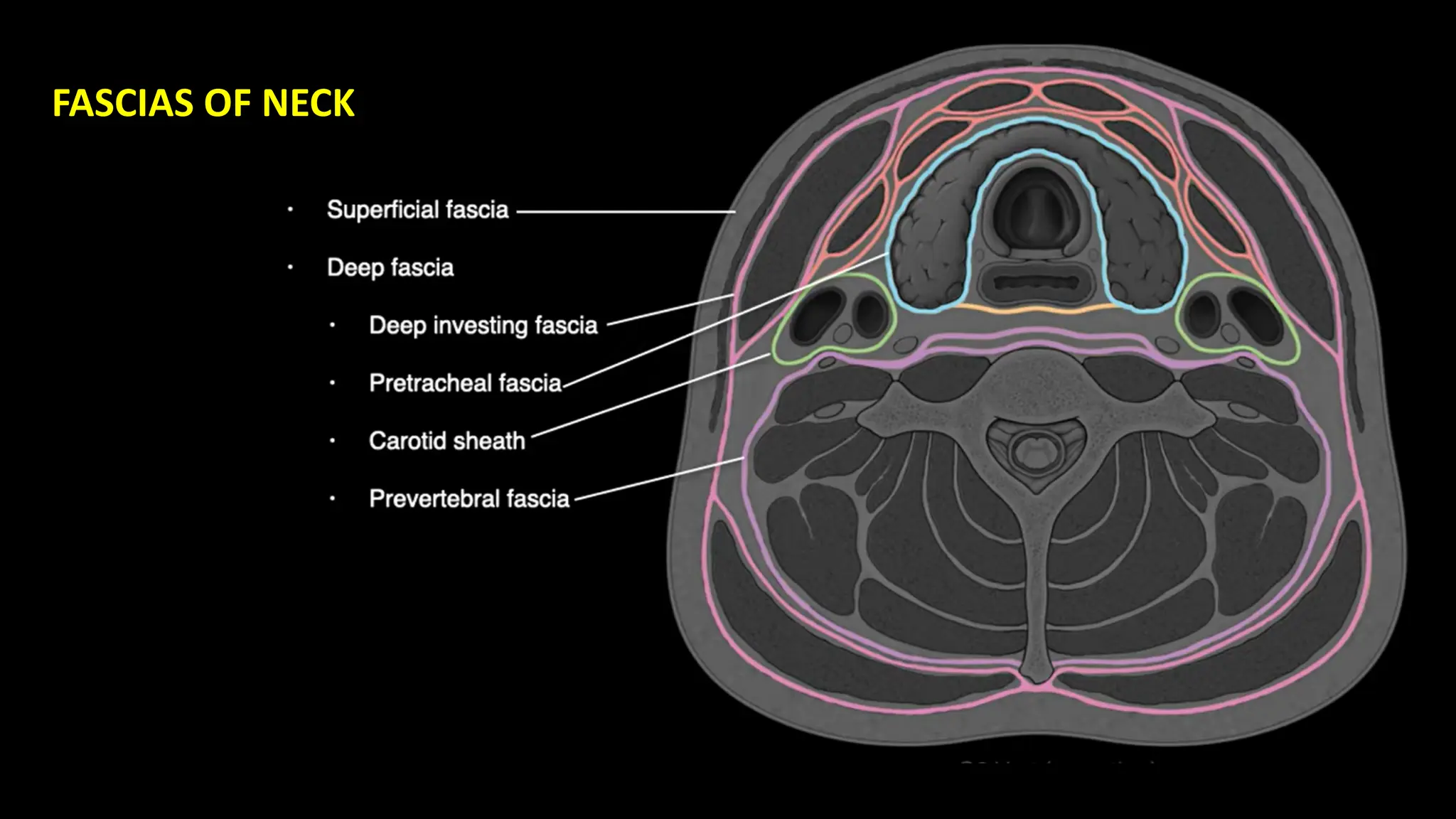 Imaging of the Infrahyoid neck spaces.pdf