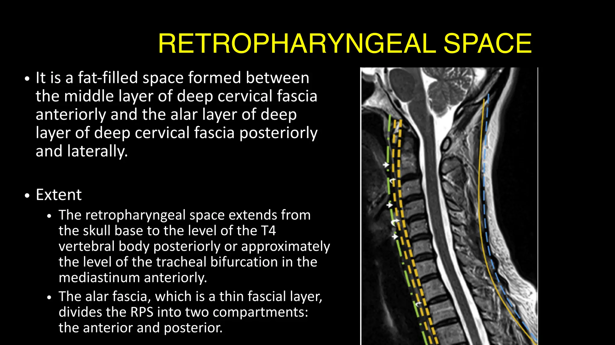 Imaging of the Infrahyoid neck spaces.pdf
