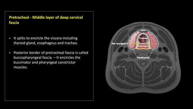 Imaging of the Infrahyoid neck spaces.pdf