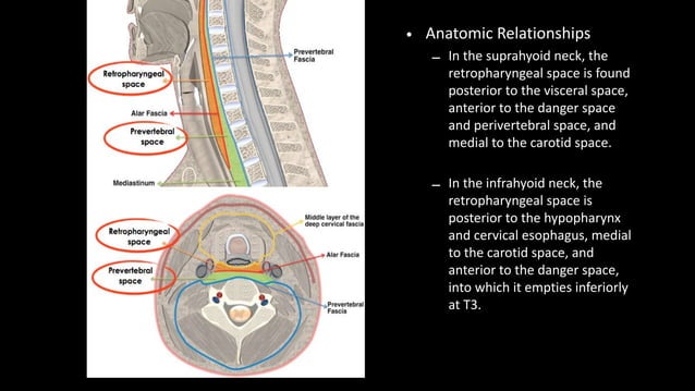Imaging of the Infrahyoid neck spaces.pdf