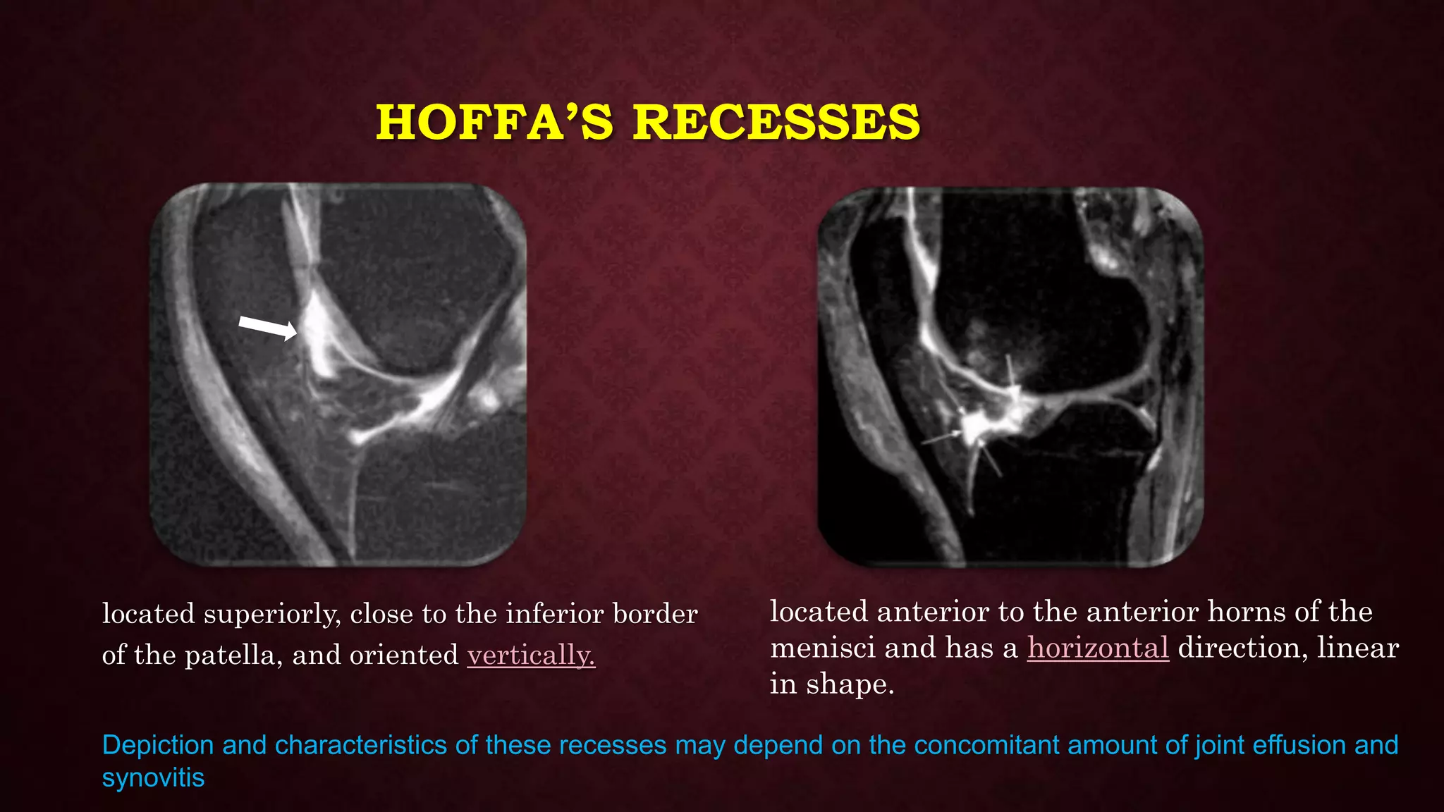 Infrapatellar fat pad abnormalities | PPTX