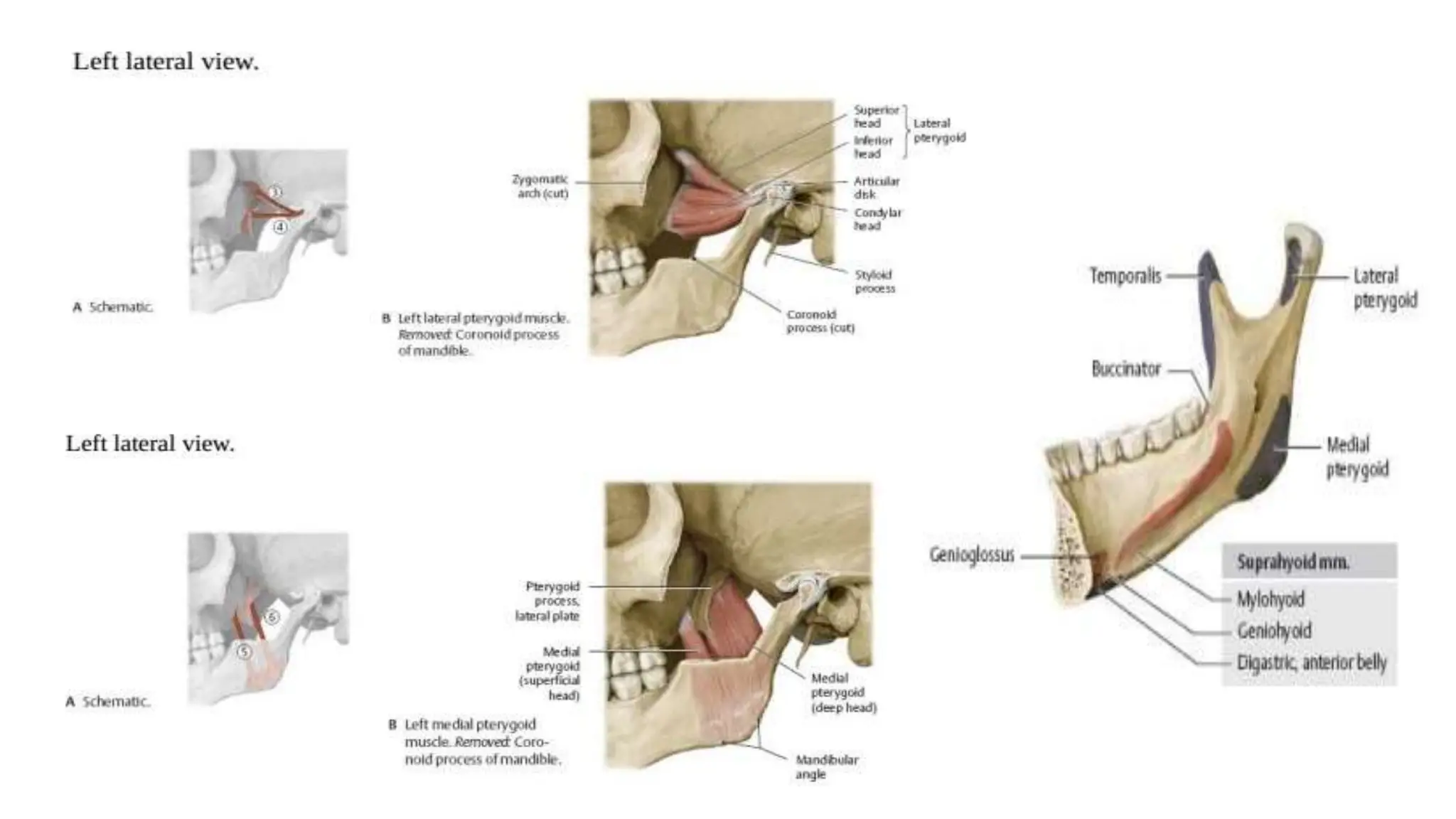 INFRATEMPORAL FOSSA AND PTERYGOPALATINE FOSSA NEW.pptx