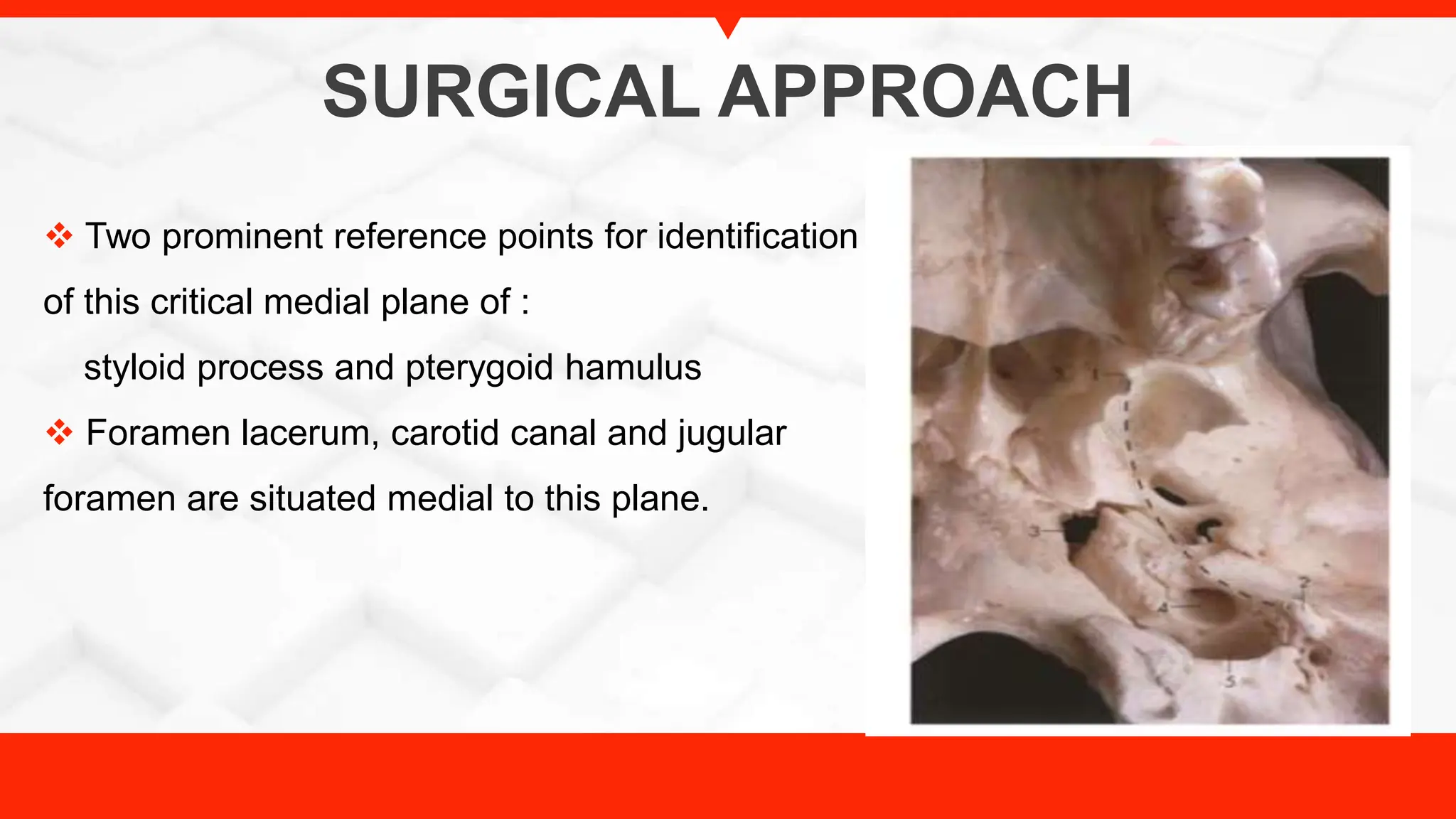 INFRATEMPORAL FOSSA AND PTERYGOPALATINE FOSSA NEW.pptx