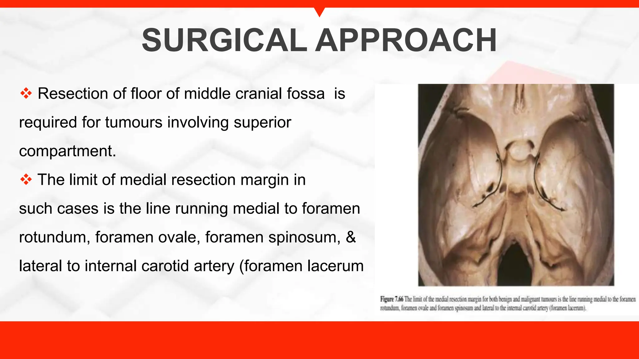 INFRATEMPORAL FOSSA AND PTERYGOPALATINE FOSSA NEW.pptx