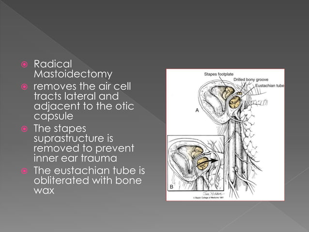 Infratemporal fossa approaches | PPTX