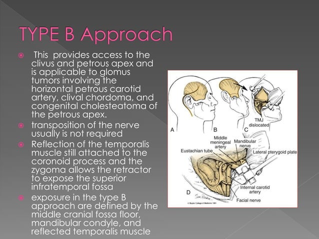 Infratemporal fossa approaches | PPTX