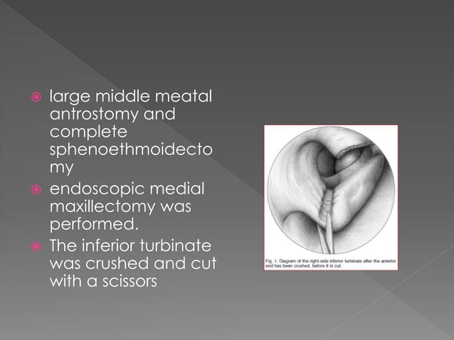 Infratemporal fossa approaches | PPTX