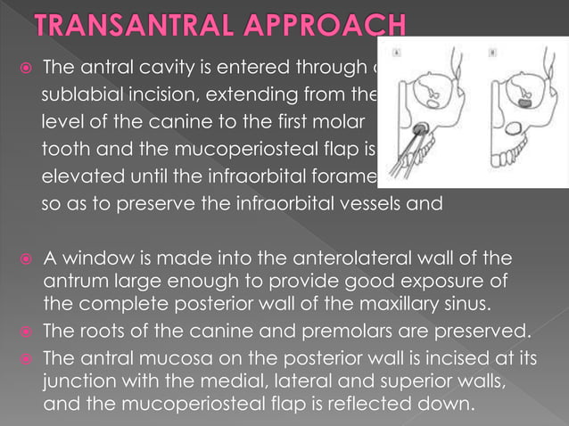 Infratemporal fossa approaches | PPTX