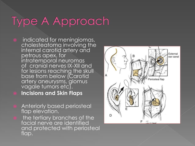 Infratemporal fossa approaches | PPTX