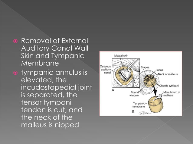 Infratemporal fossa approaches | PPTX
