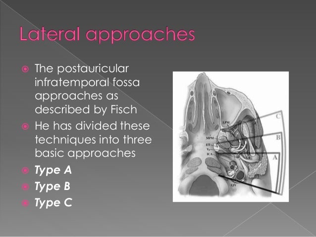 Infratemporal fossa approaches