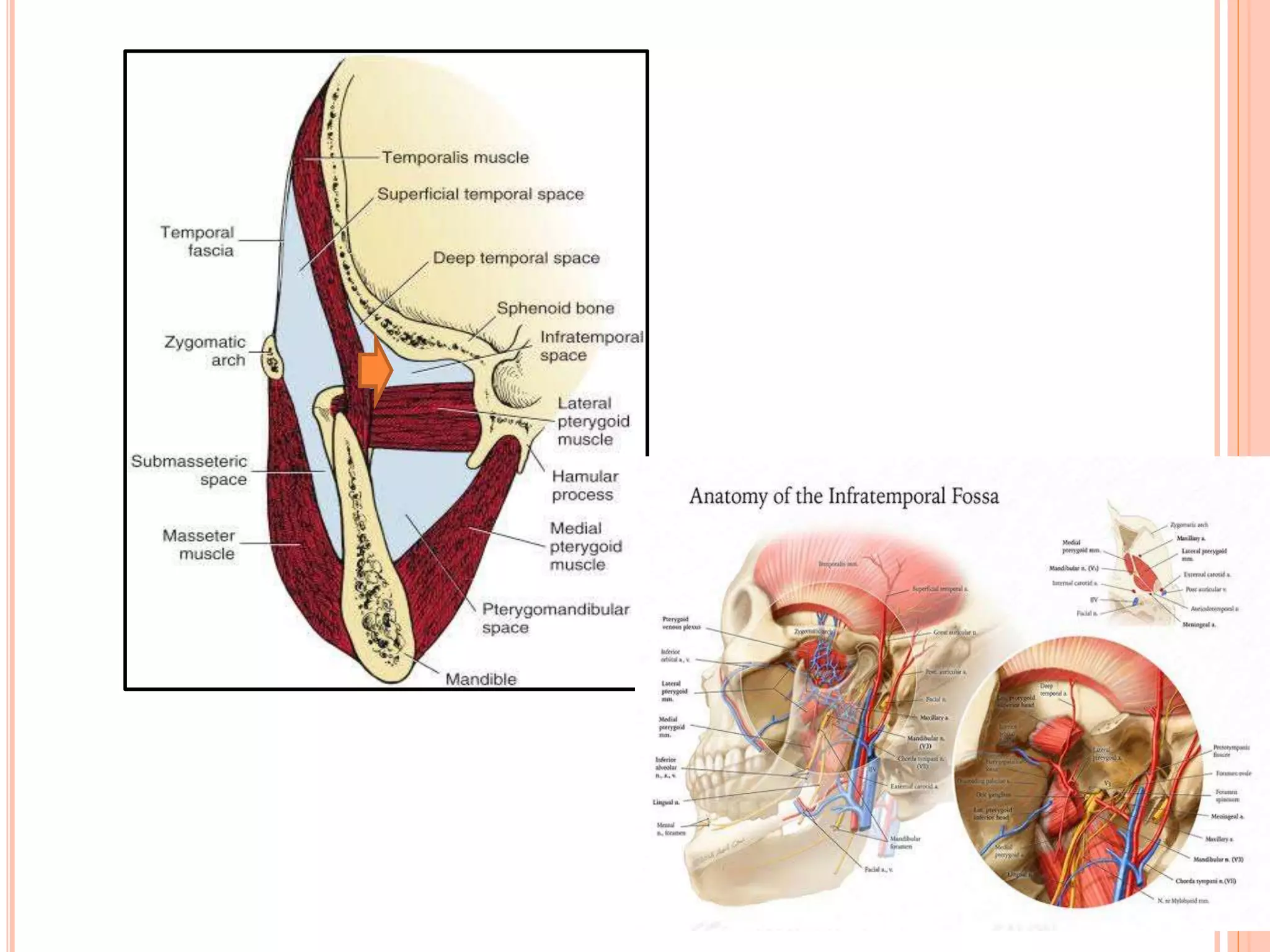 Infra temporal space infection ppt | PPTX