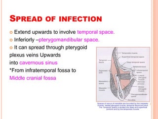 Infra temporal space infection ppt | PPTX