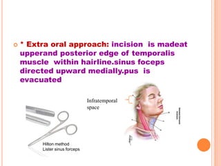 Infratemporal Space Infection