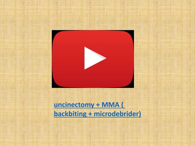 Infundibulotomy & Maxillary sinusotomy pg | PPT