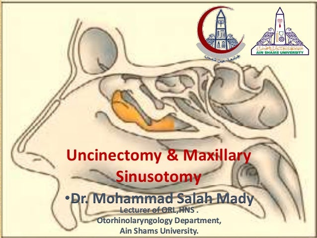 Infundibulotomy & Maxillary sinusotomy pg