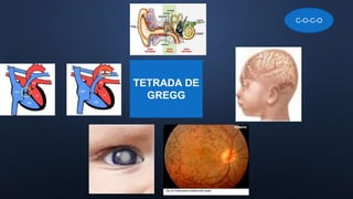 INFECCIONES DEL RECIÉN NACIDO | PPTX