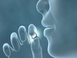 Ingestible robots | PPT