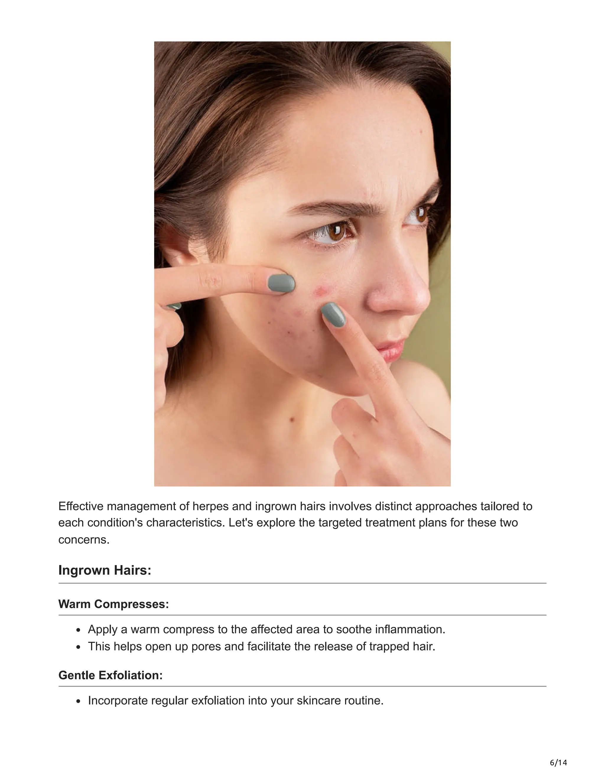 Ingrown Hair vs. Herpes: What are the Differences? | PDF