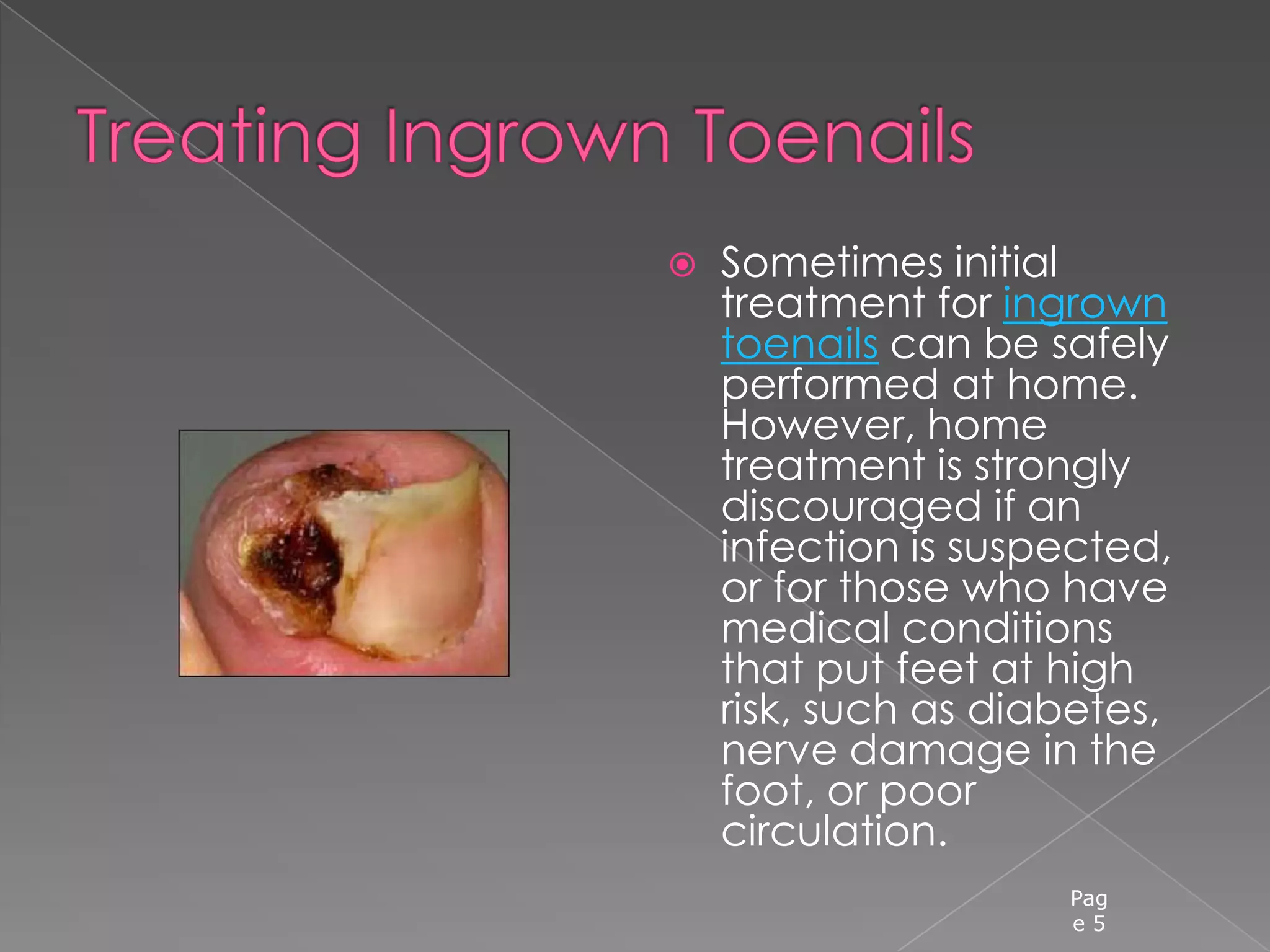 Ingrown toenails | PPTX