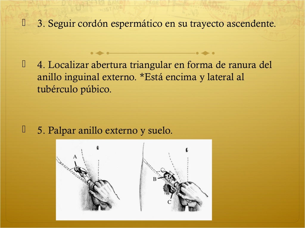 Exploración de región Inguinal