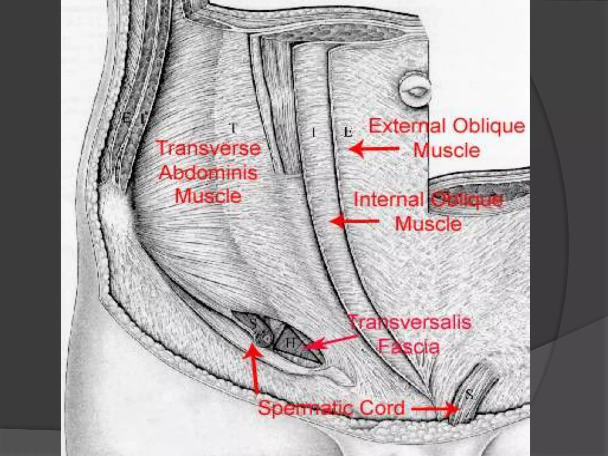 INGUINAL REGION | PPTX