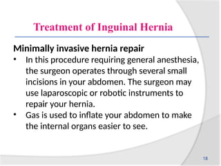 Inguinal-Herniaaaaaaaaaaaaaaaaaaaaaaaaaaa | PPTX